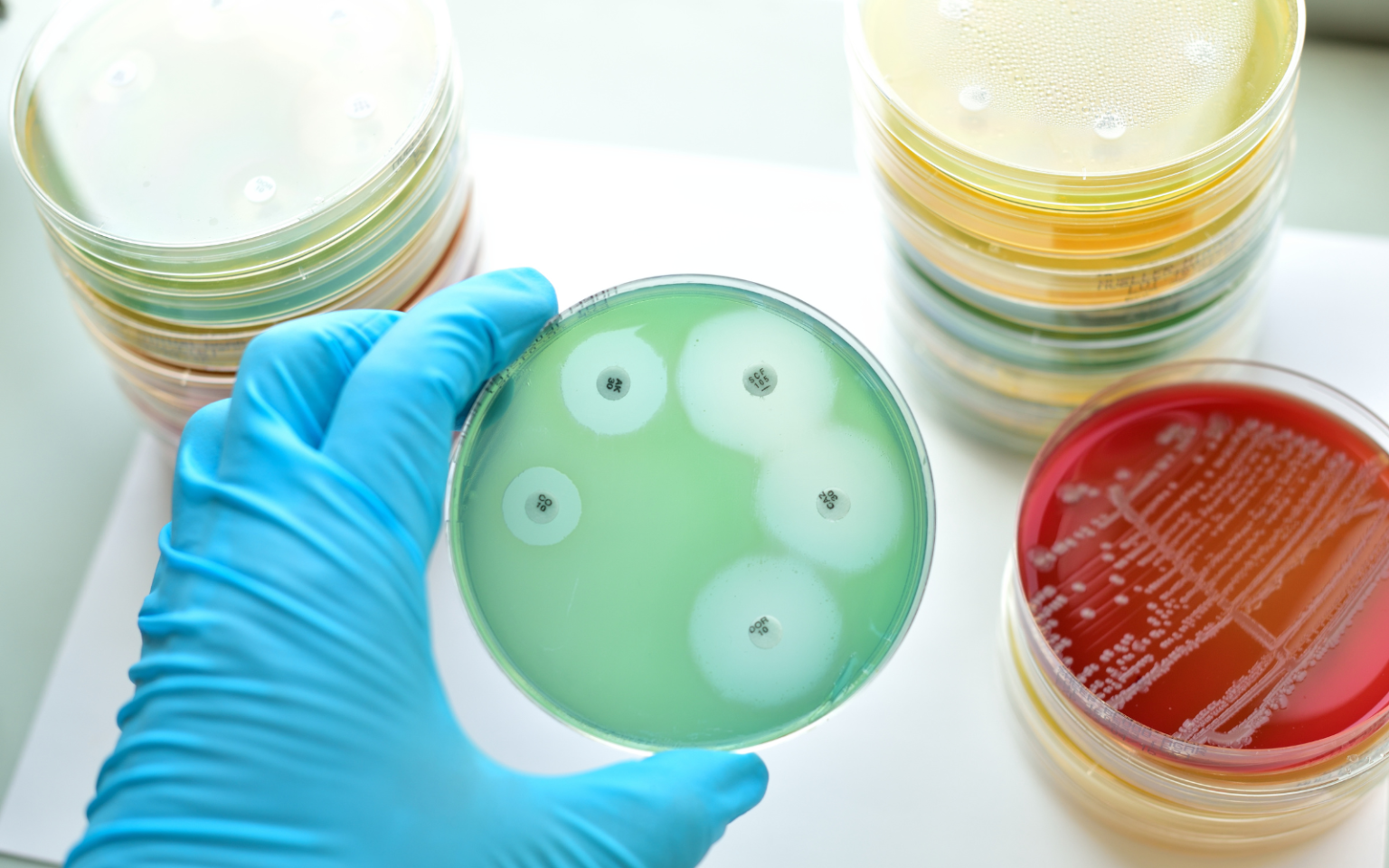 Awanui — News — Antibiotic stewardship – how changing lab reporting can ...